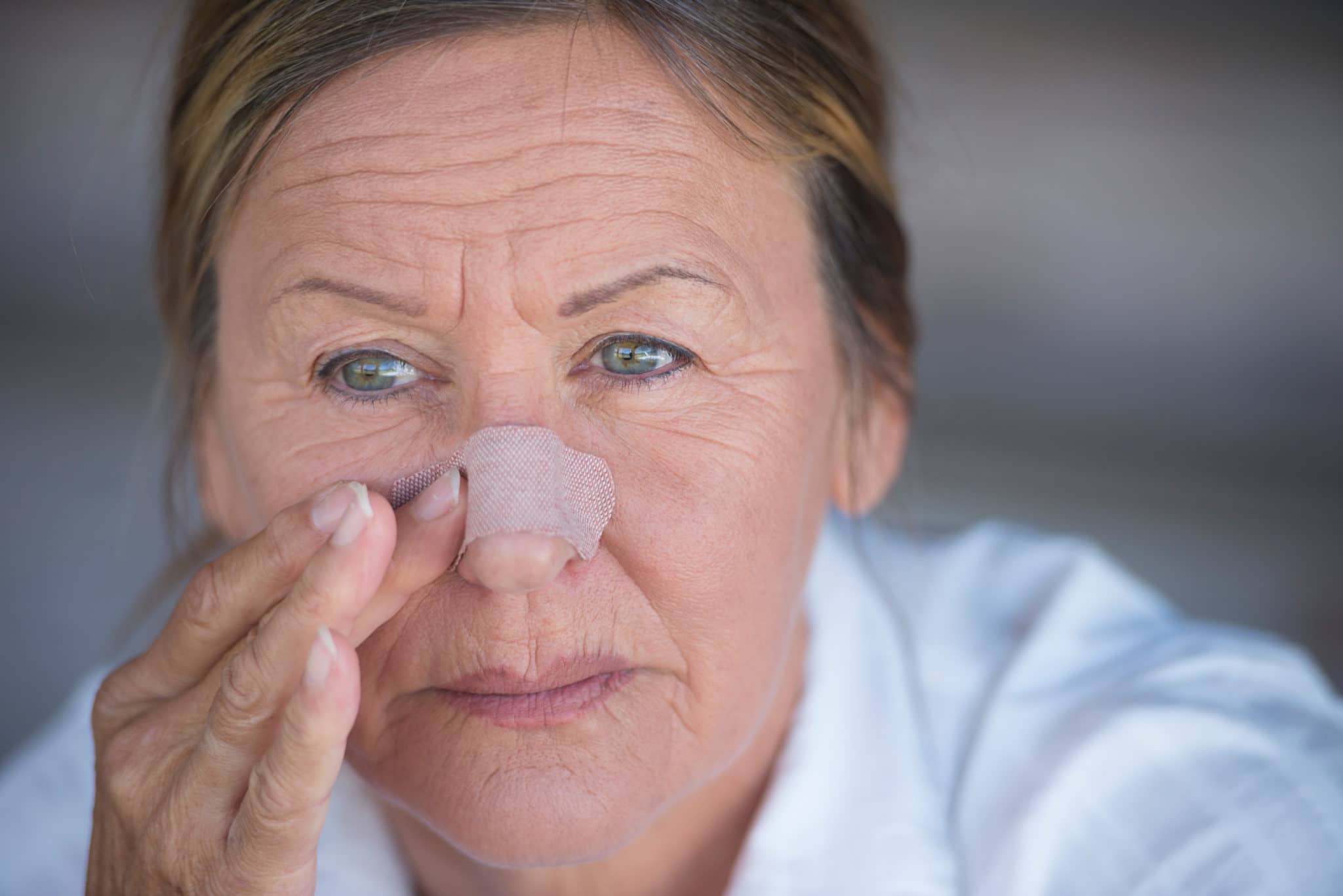 Nasal Fracture - Central Alabama ENT Associates